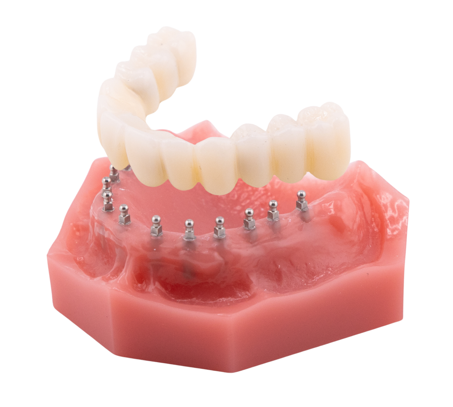 Fixed Permanent Bridge in Butler, PA | Brockley Dental Center